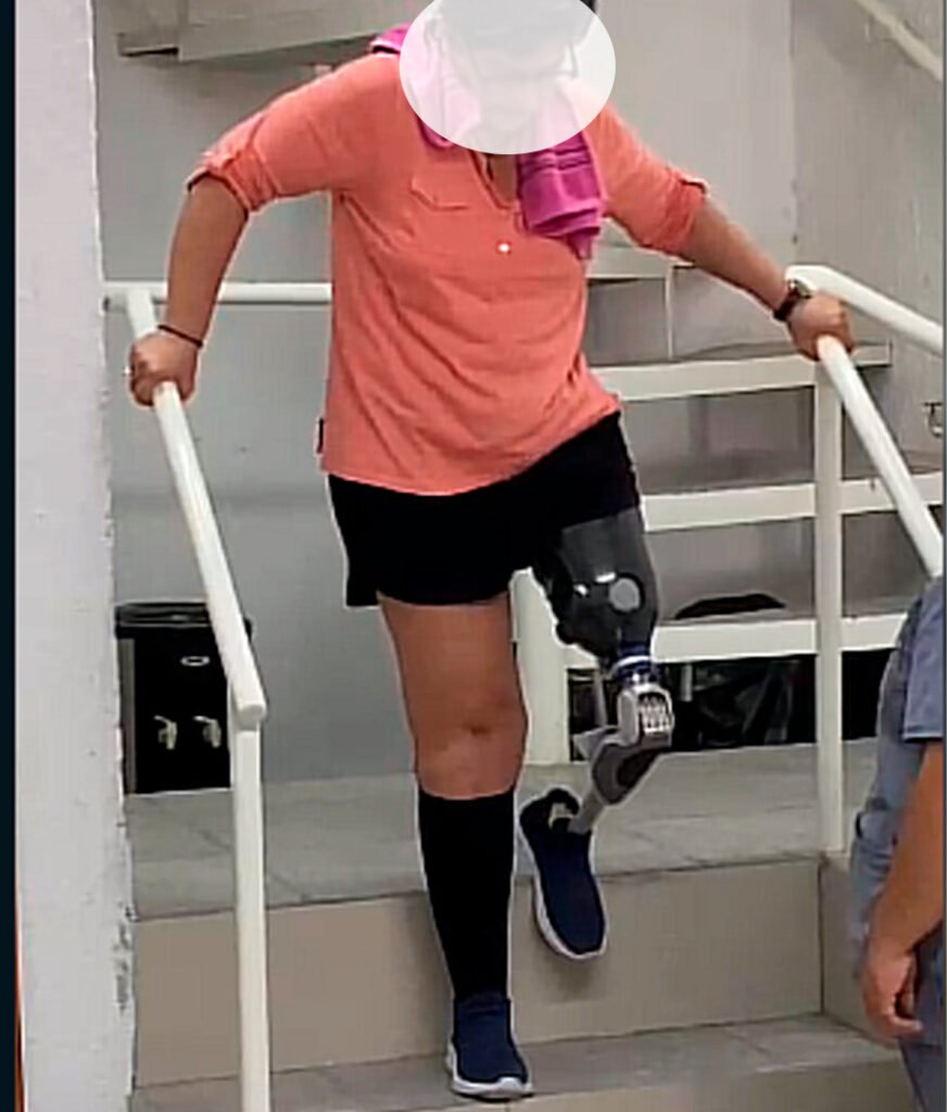 Rodilla 3r85 Dynion, Ottobock - Prótesis OMX